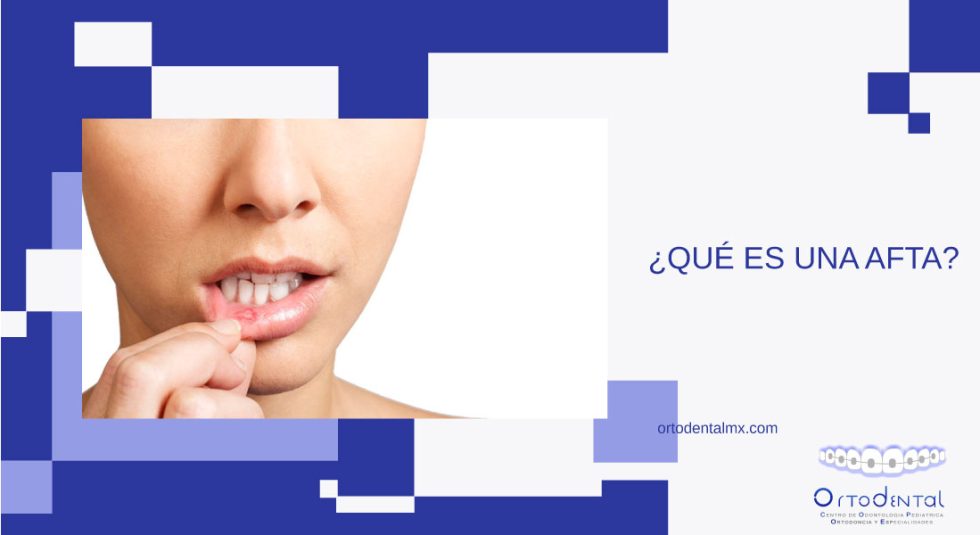 ¿Qué es un afta? - Ortodental